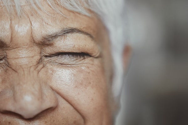 Different Types of Skin Aging: Intrinsic Aging vs. Extrinsic Aging ...